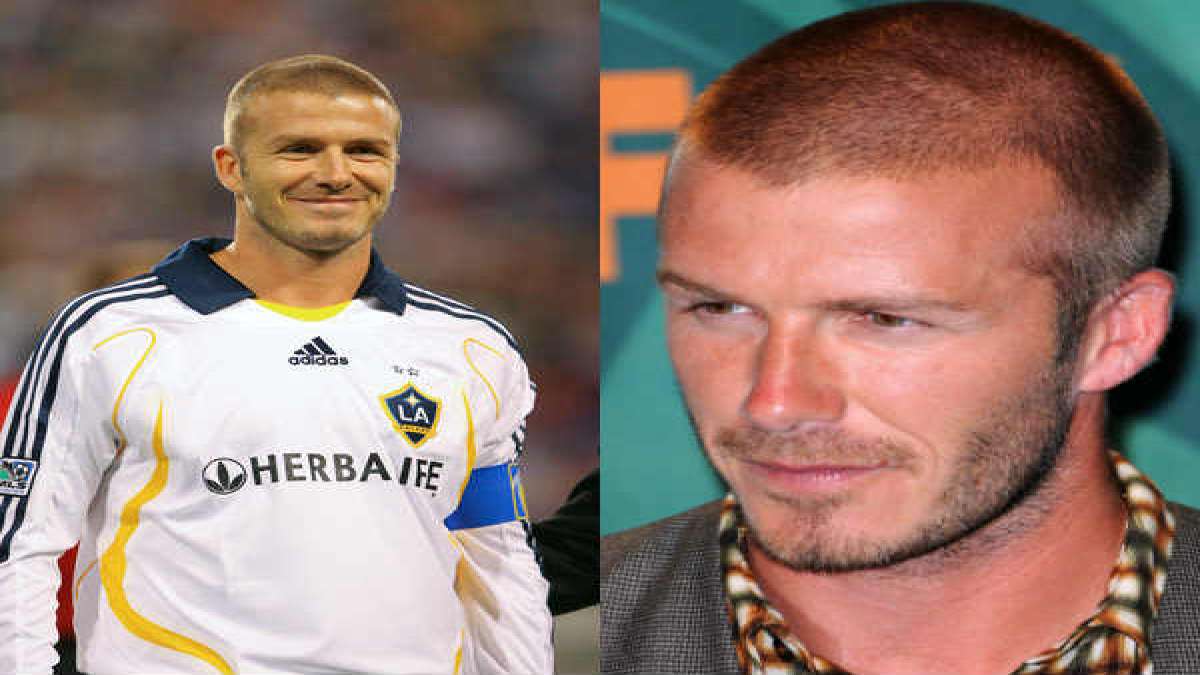 Men Balding Patterns: How To Hide It? - Boldsky.com