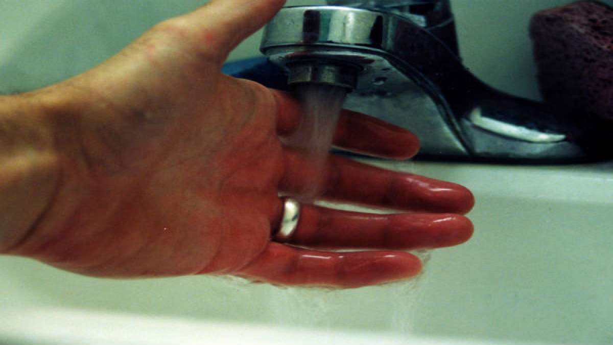 Tips To Care For Minor Burns At Home - Boldsky.com