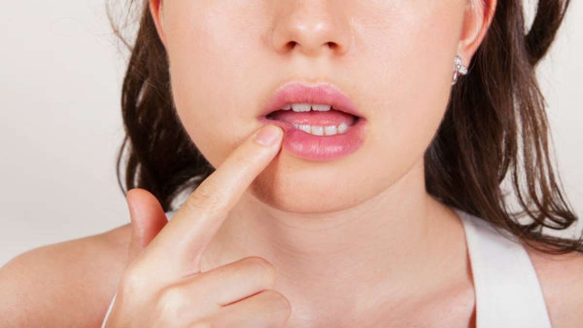 8 Reasons Why Your Lips Are Dry - Boldsky.com