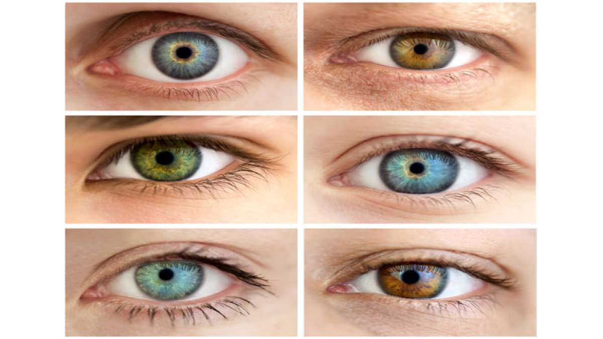 Get Rid Of Sagged Eyelids In Just 2 Minutes! - Boldsky.com