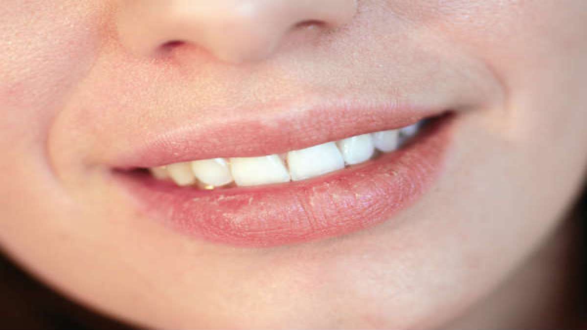 What To Do When You Have Rashes On Your Upper Lip? - Boldsky.com