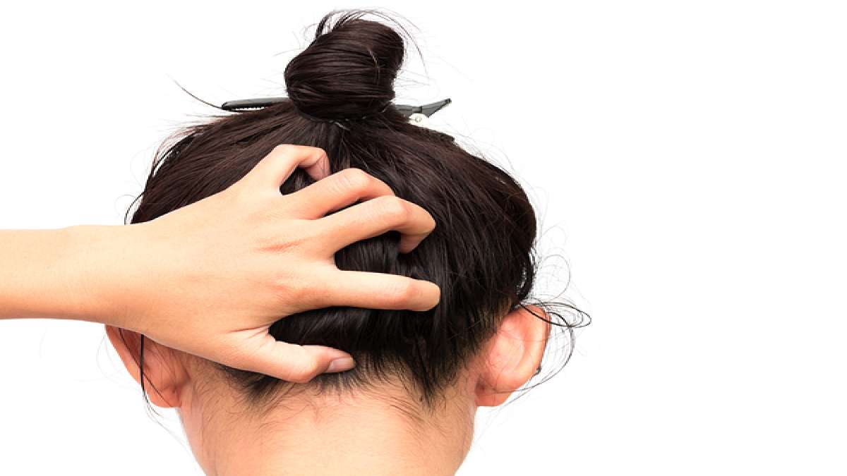 What To Do If You Have Dry Patches On Scalp? - Boldsky.com