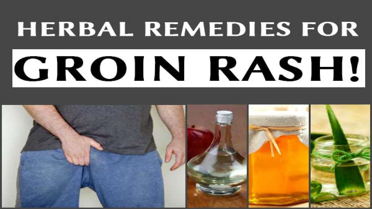 Herbal Remedies For Groin Rash! - Boldsky.com