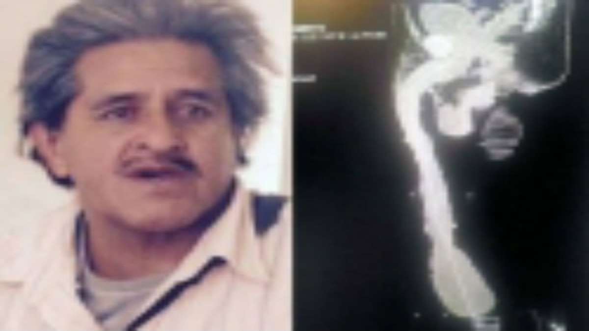 WHATT! This Man Has The World's Largest Penis! - Boldsky.com