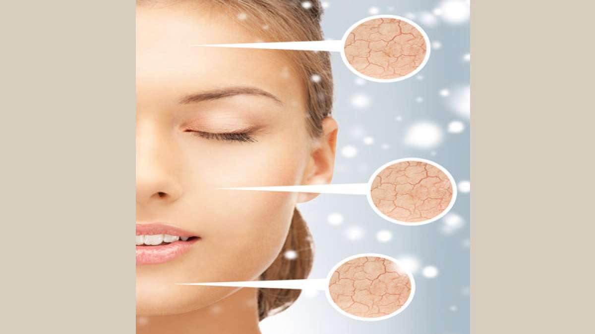 Home Remedies To Treat Dry Skin - Boldsky.com
