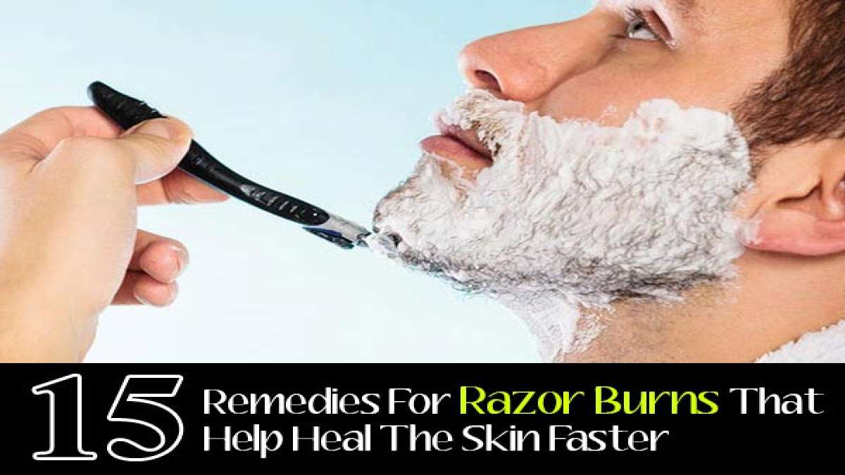15 Home Remedies For Razor Burns That Help Heal The Skin Faster ...