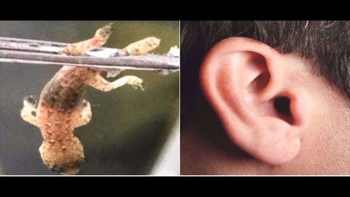Disturbing Fact: Lizard Found In Man's Ear & Its Tail Is Missing ...