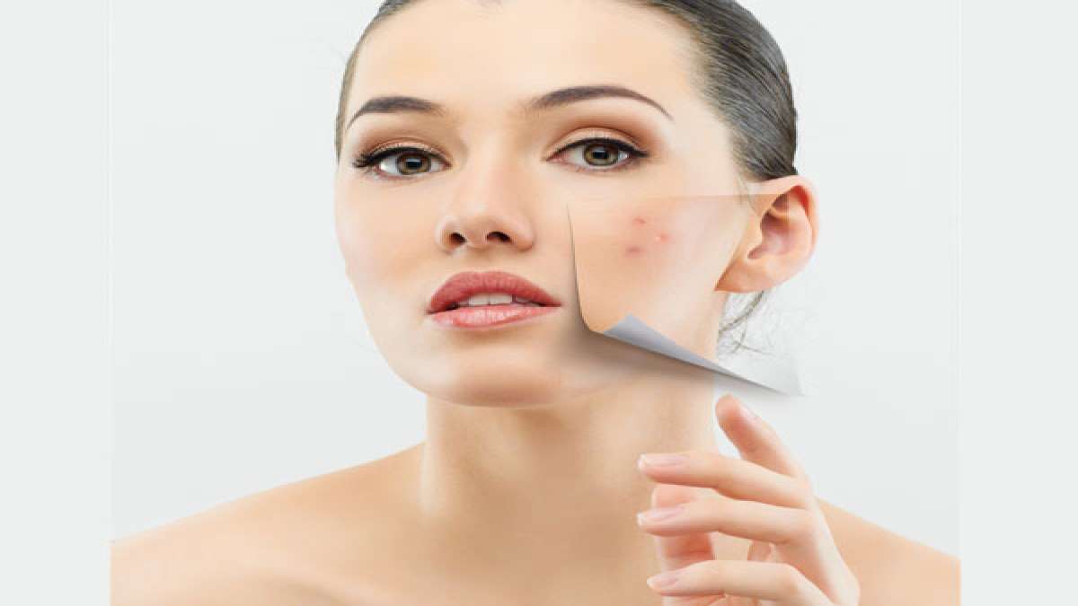 Hide A Pimple Easily With These Amazing Makeup Hacks - Boldsky.com