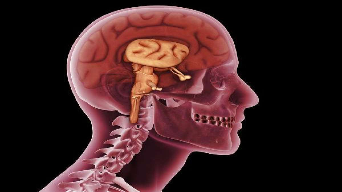 How is delirium different from dementia? - Boldsky.com