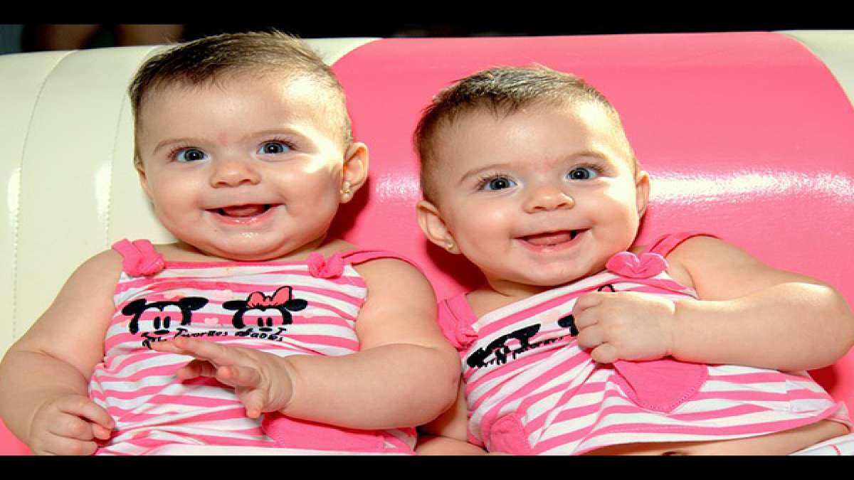 Monochorionic Monoamniotic (MoMo) Twins: Diagnosis, Complications and ...