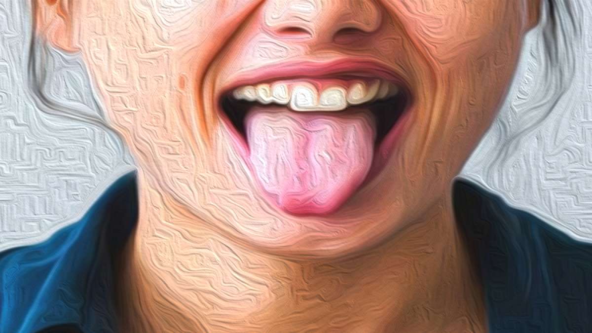 Treat Tongue Cuts With These 10 Natural Home Remedies - Boldsky.com