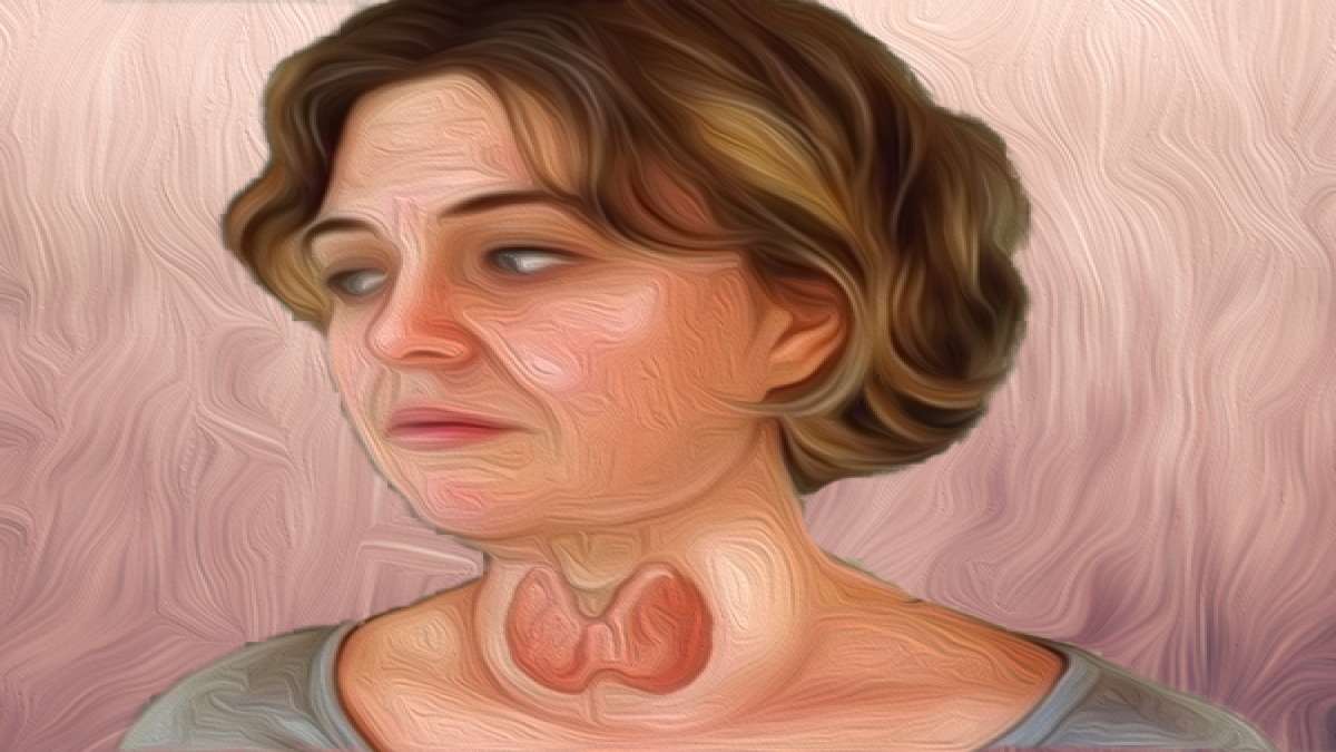 28 Amazing & Effective Home Remedies For Goitre - Boldsky.com