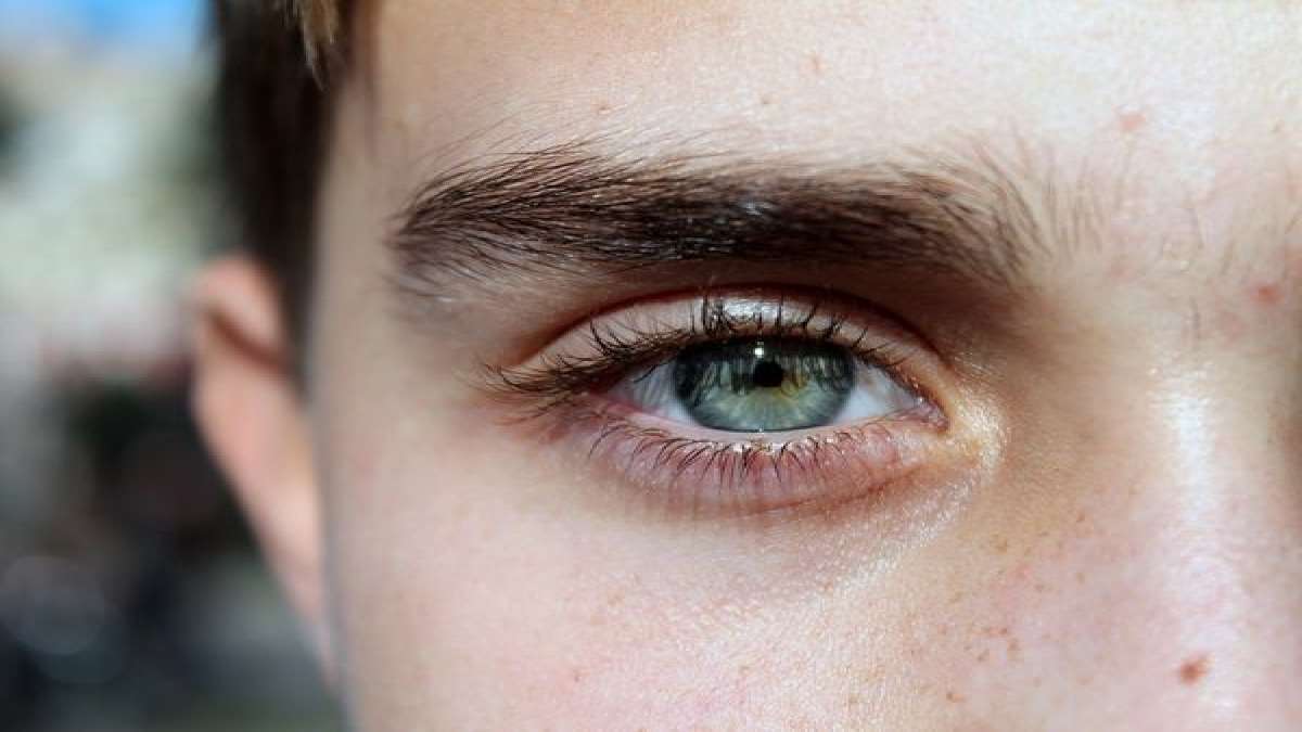 Madarosis: Symptoms, Causes, Diagnosis & Treatment - Boldsky.com