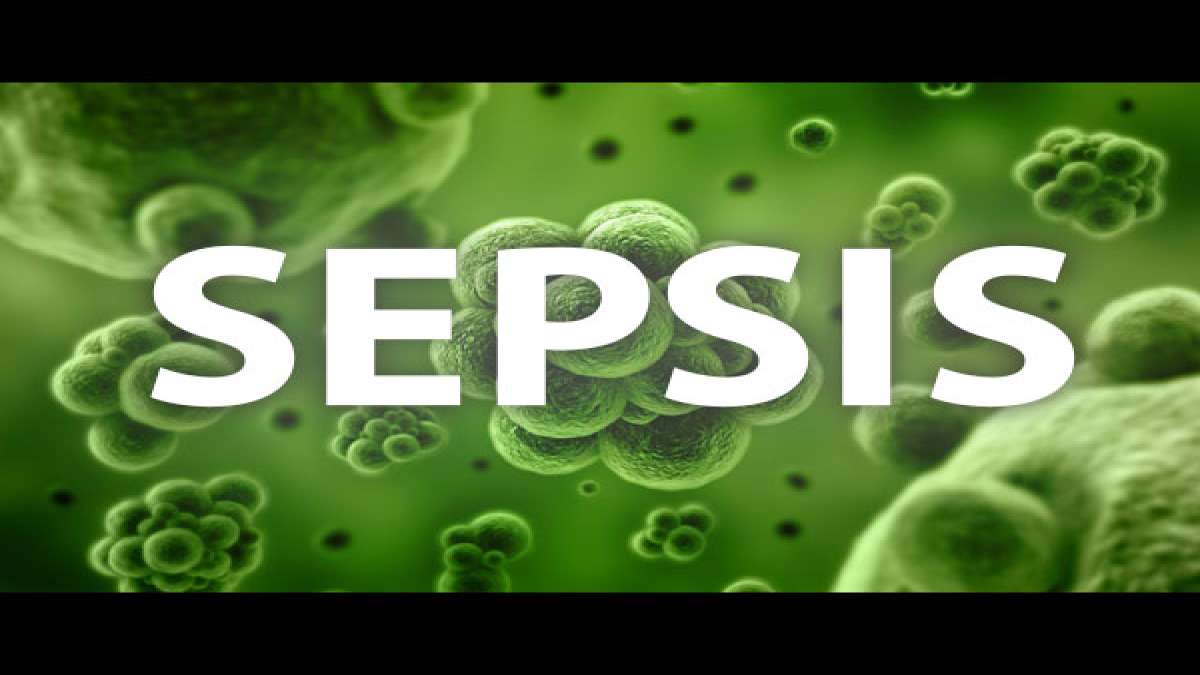 World Sepsis Day 2019: Sepsis: Causes, Symptoms, Effects, Diagnosis And ...