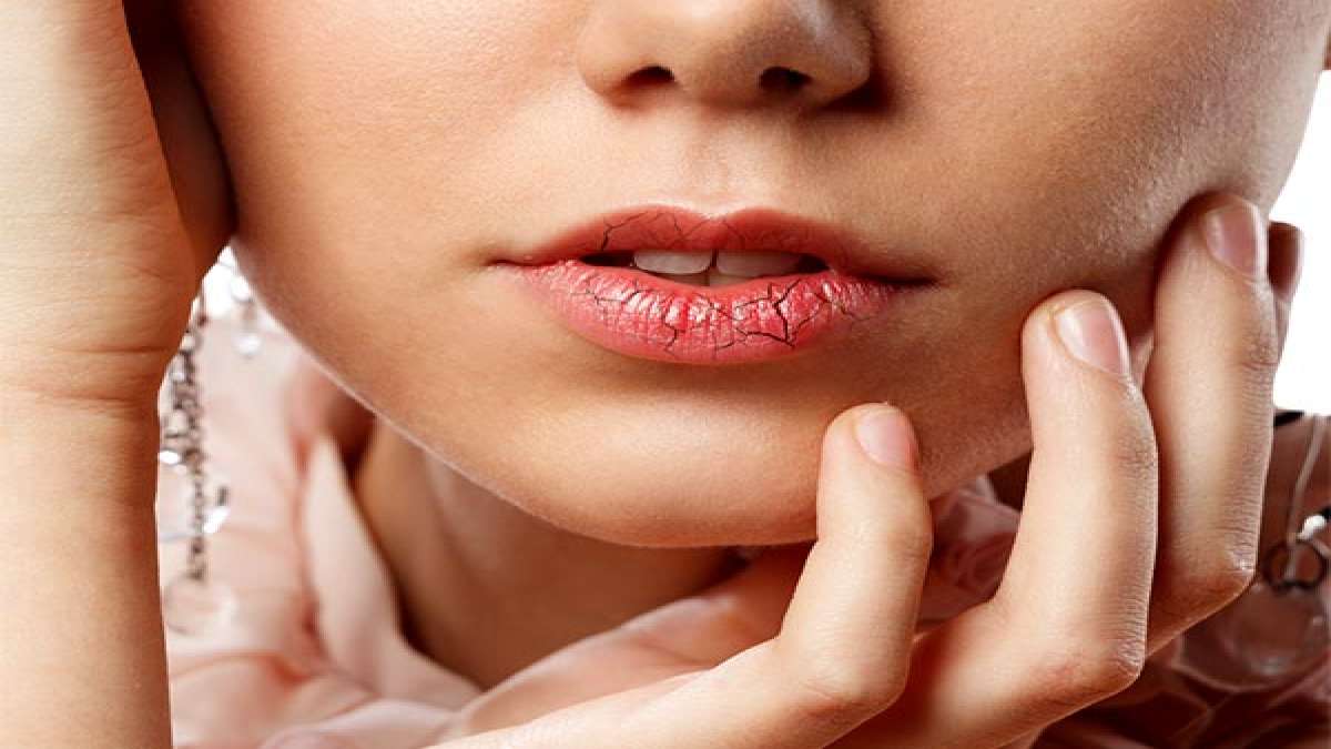 Mucocele (Mucous Cyst): Causes, Symptoms And Treatment - Boldsky.com