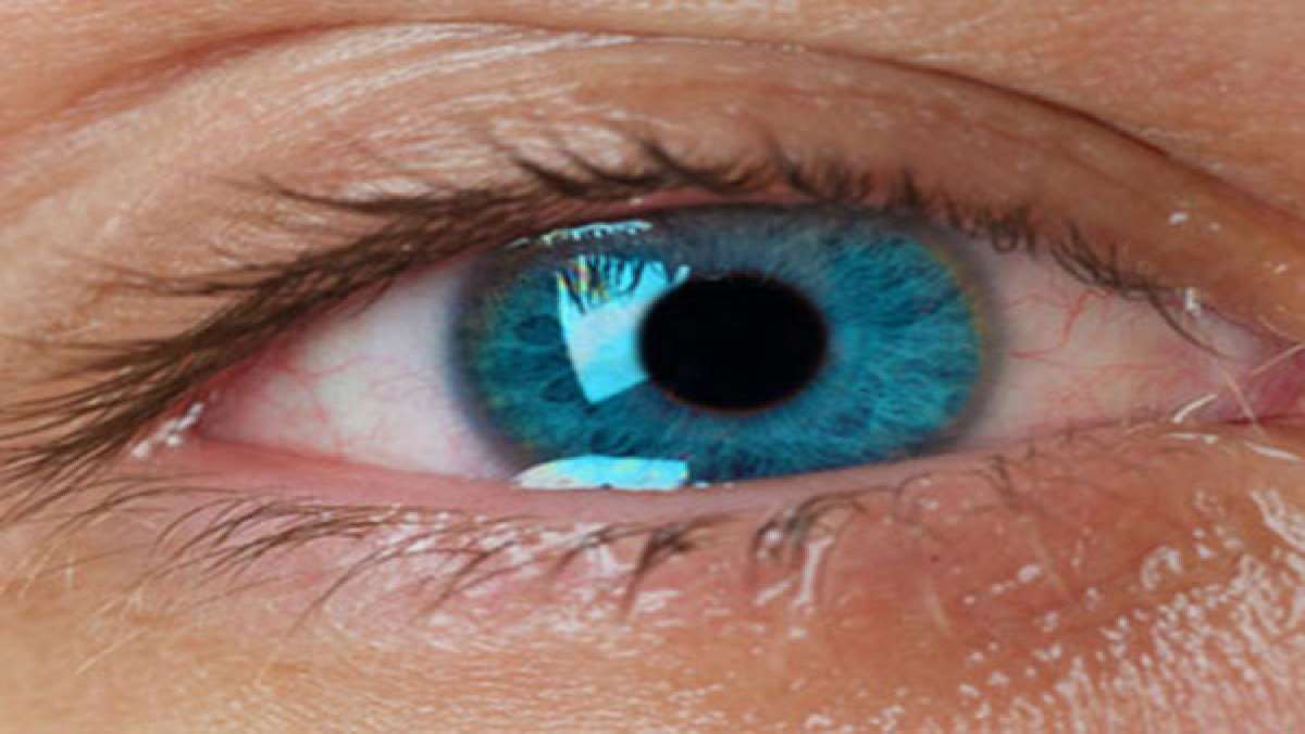 Epiphora (Watering Eyes) - Causes, Symptoms, Diagnosis And Treatment ...