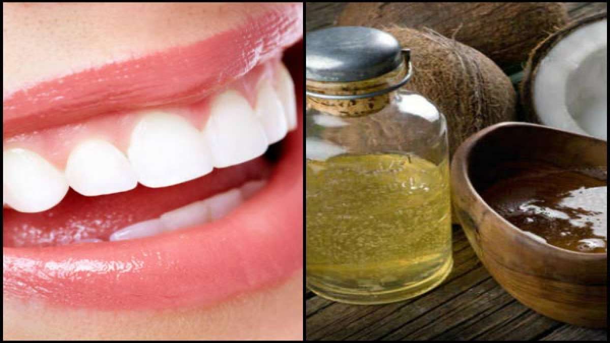 Coconut Oil For Teeth: Benefits And How To Use It - Boldsky.com