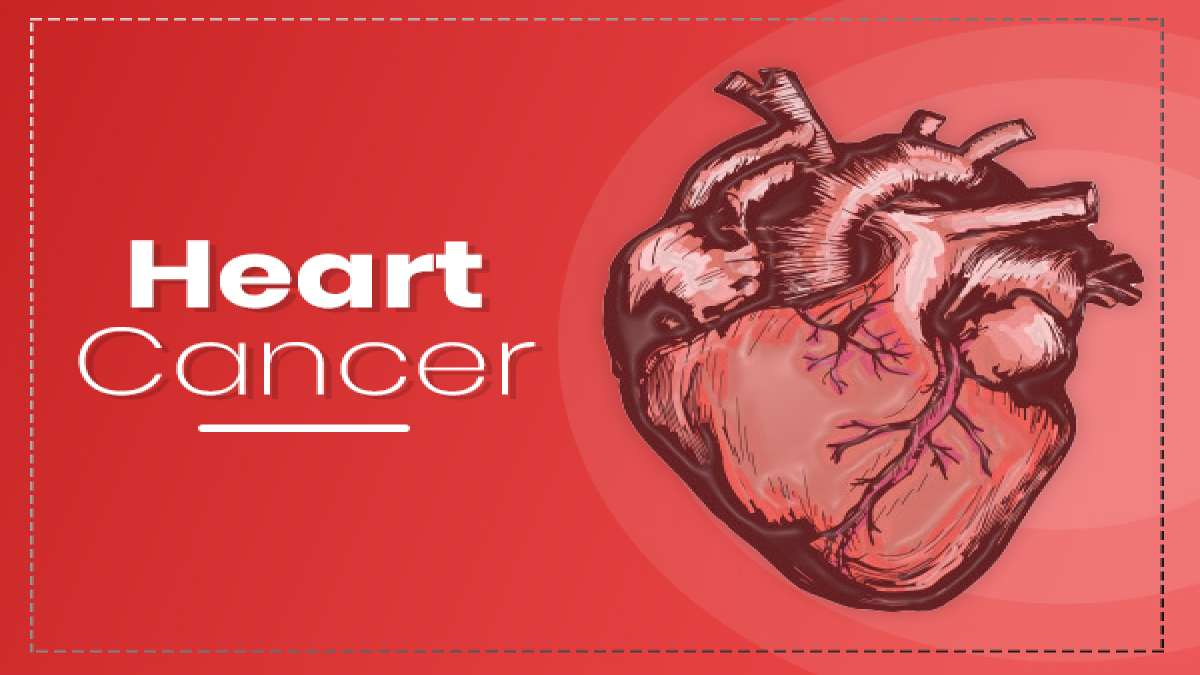 Heart Cancer: Causes, Symptoms, Risk Factors, Treatment And Prevention ...