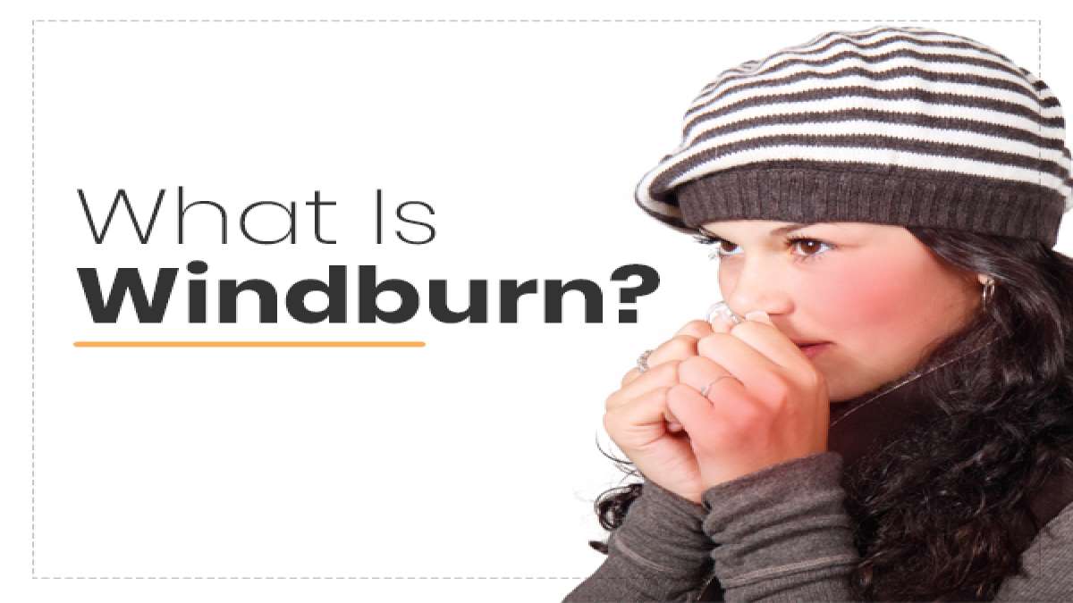 Windburn: Causes, Symptoms, Treatment And Prevention - Boldsky.com