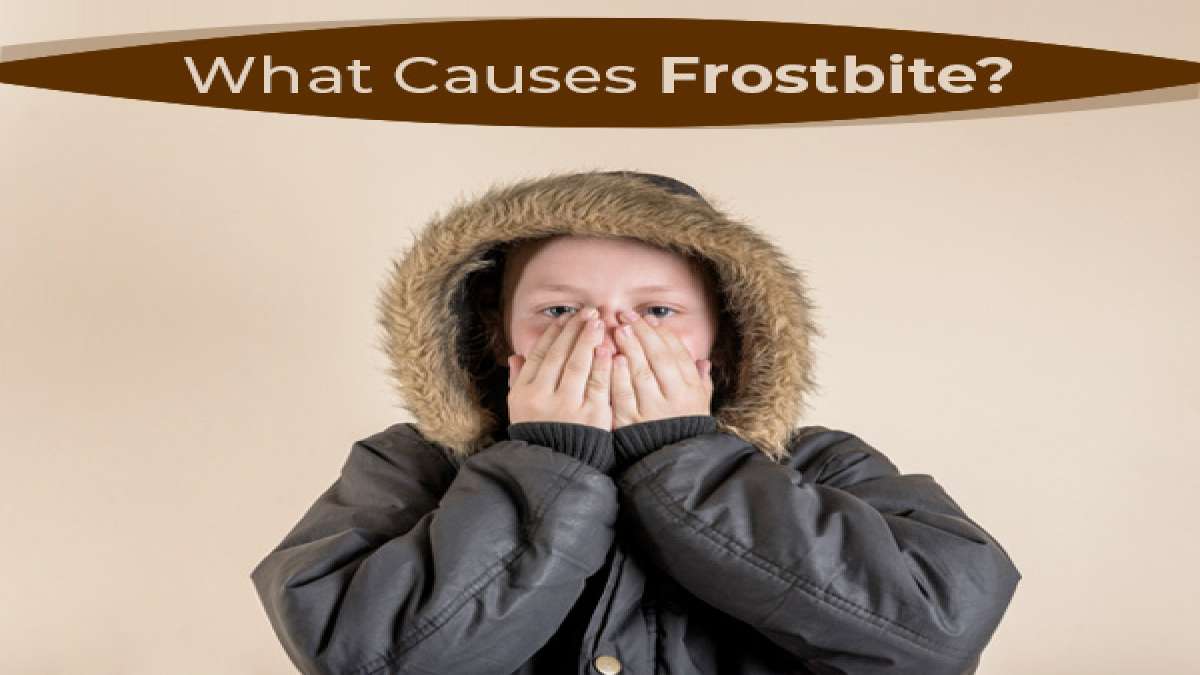 Frostbite: Causes, Symptoms, Stages, Risk Factors, Diagnosis ...