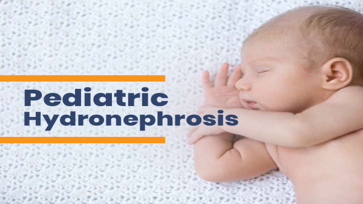 Paediatric Hydronephrosis: Causes, Types, Symptoms, Diagnosis And ...