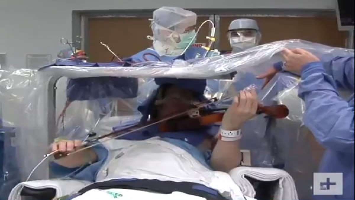 Viral: Patient Plays Violin During His Brain Surgery To Help Doctor ...