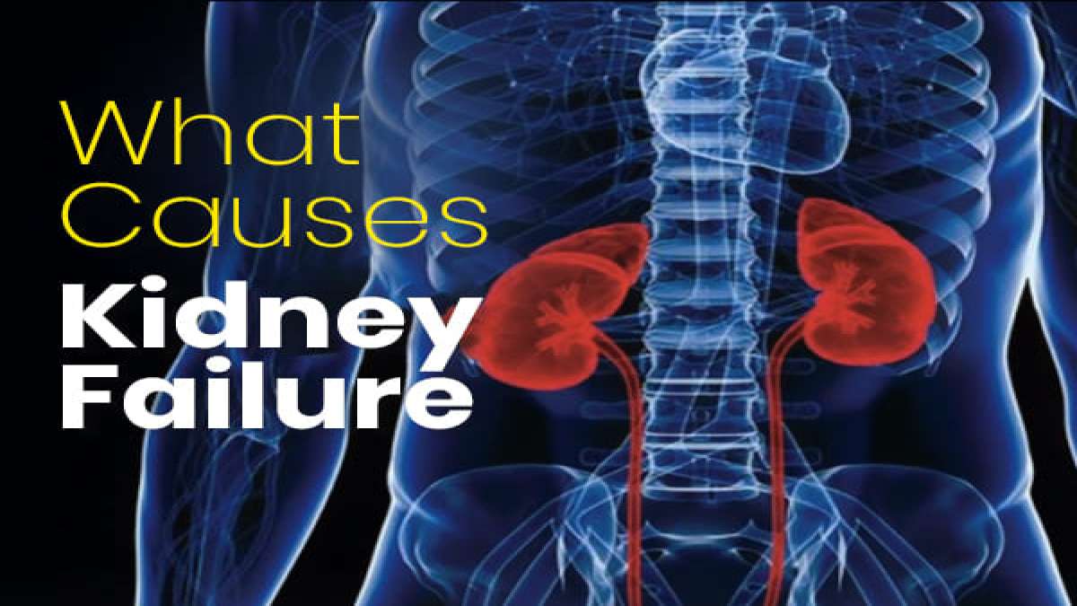What Causes Kidney Failure And How It Can Be Treated - Boldsky.com
