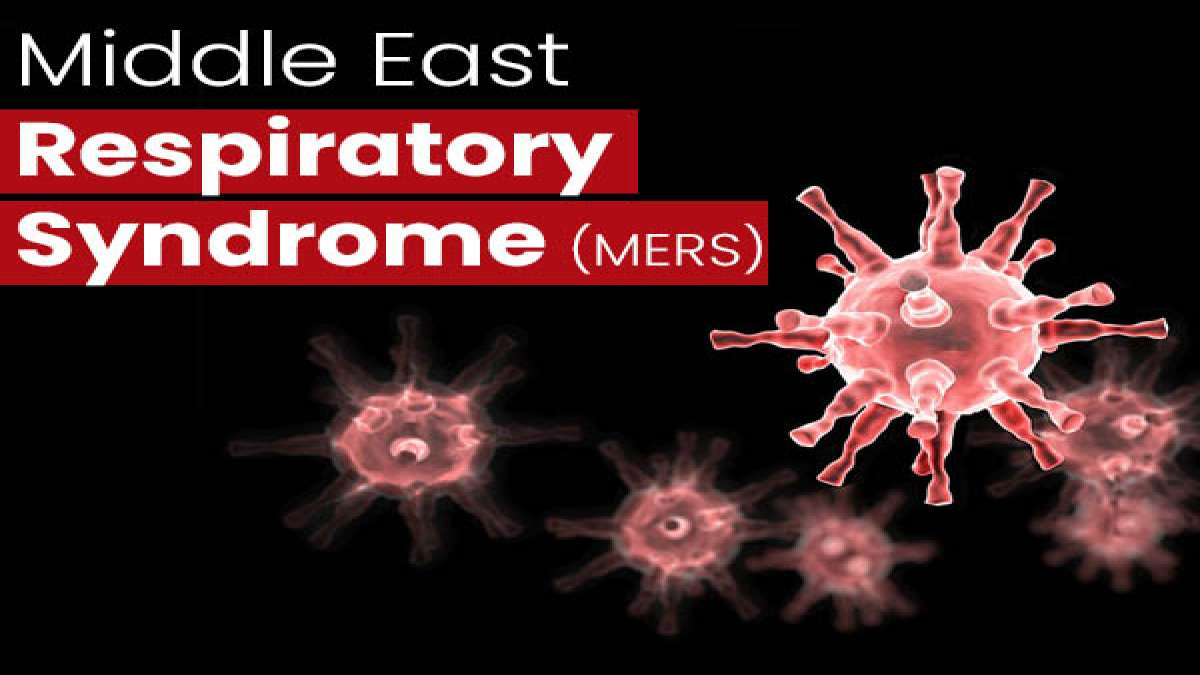 Middle East Respiratory Syndrome (MERS-CoV): Causes, Symptoms ...