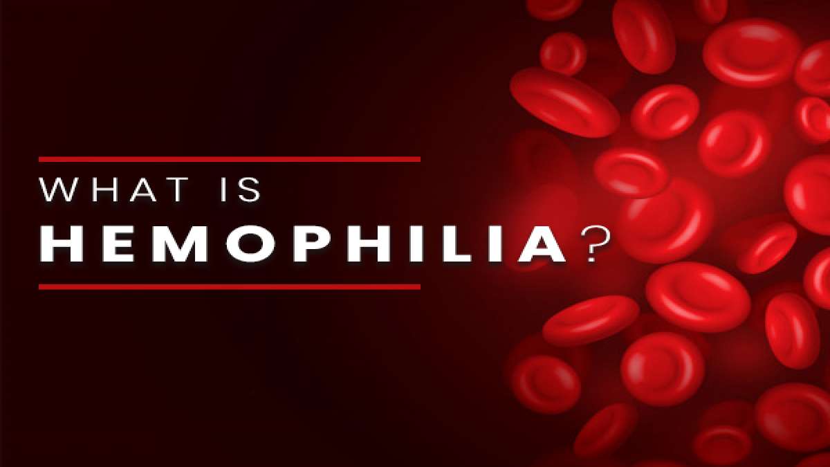 What Is Haemophilia? Its Causes, Symptoms, Complications, Diagnosis ...