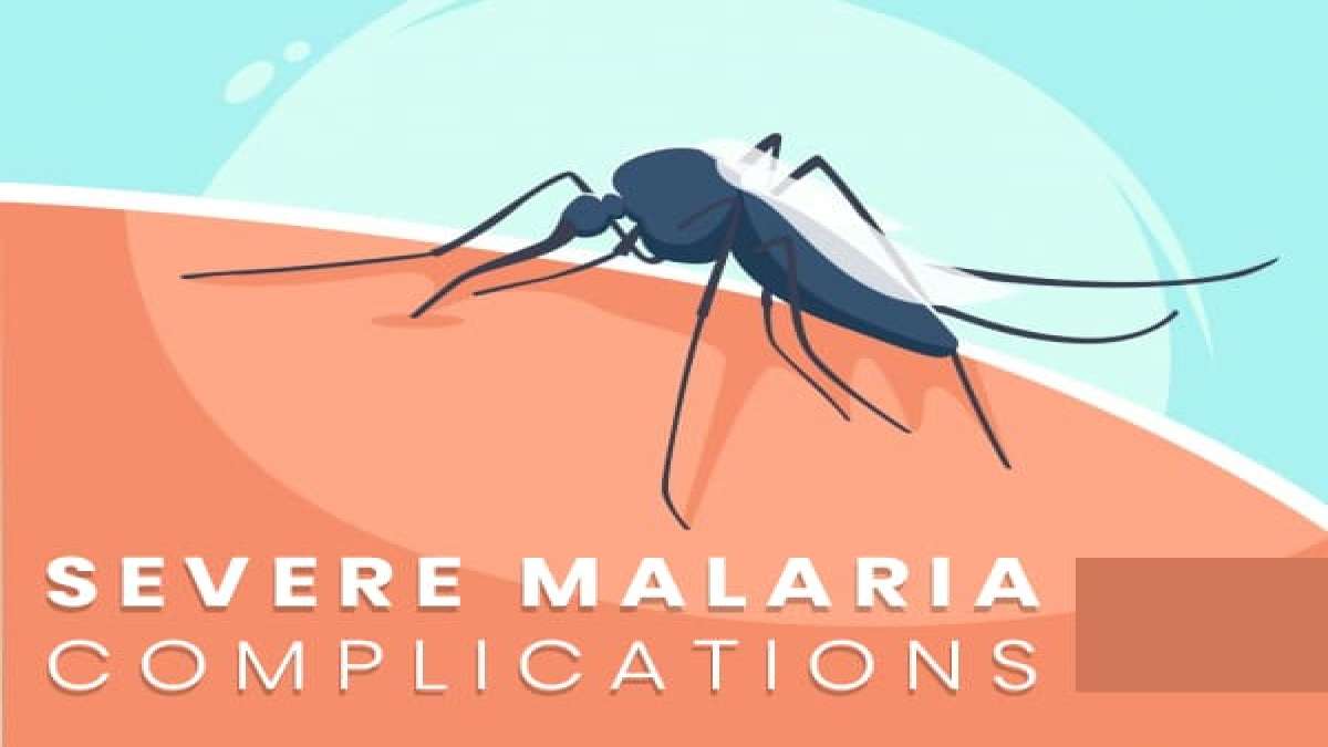 9 Malaria Complications You Need To Be Aware Of - Boldsky.com