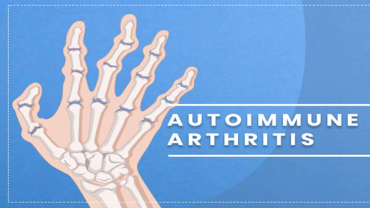 Autoimmune Arthritis: Causes, Types, Symptoms, Diagnosis And Treatment ...