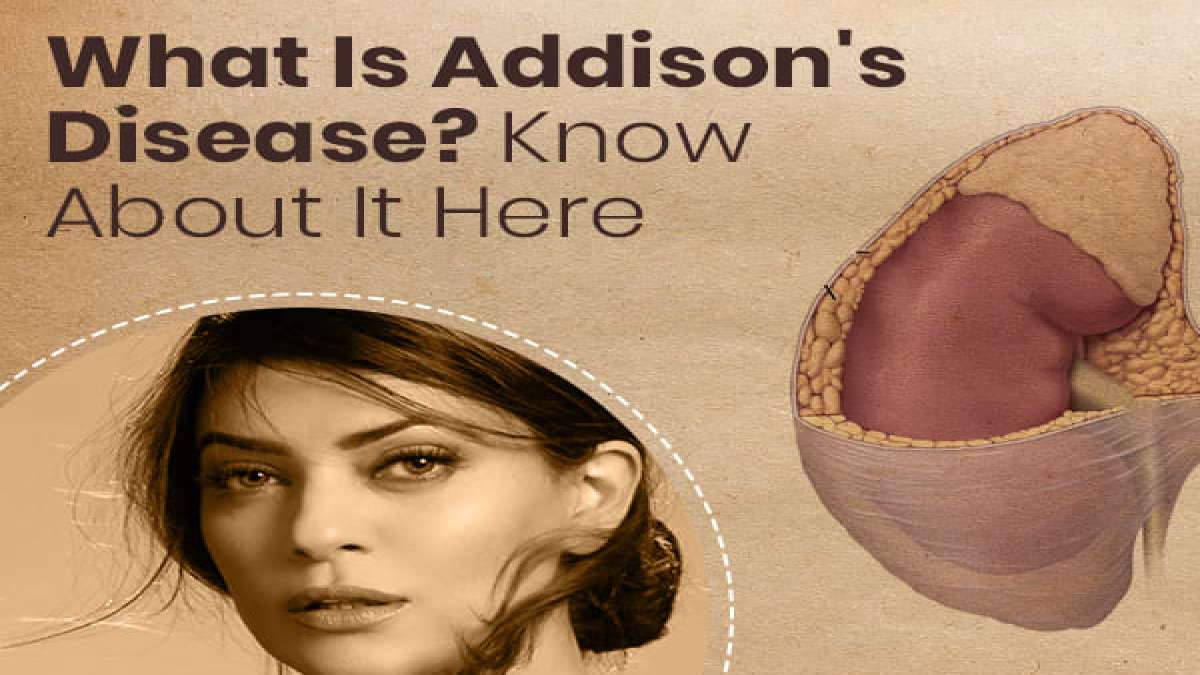 Addison's Disease: Symptoms, Causes, Risk Factors And Treatment ...