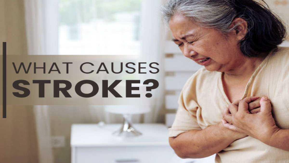 Stroke: Causes, Symptoms, Diagnosis And Treatment - Boldsky.com