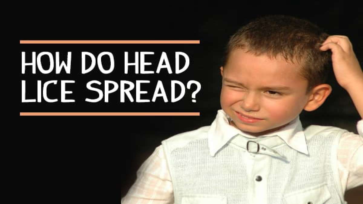 Head Lice: How Do They Spread? Symptoms, Treatment and Prevention ...