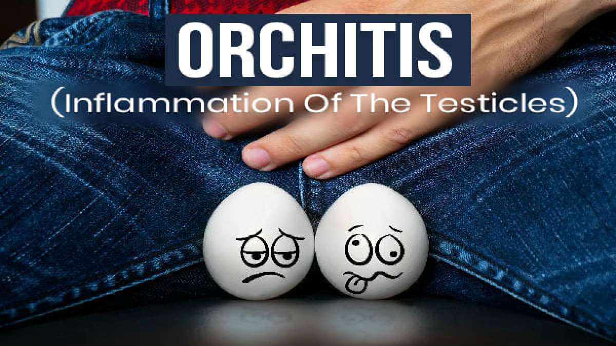 Orchitis (Inflammation Of The Testicles): Causes, Symptoms, Risk ...