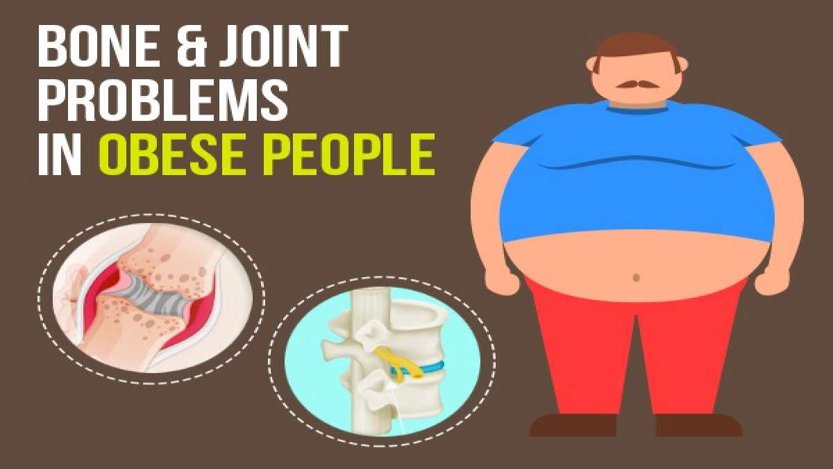 National Bone And Joint Day 2020: Bone And Joint Problems In Obese ...
