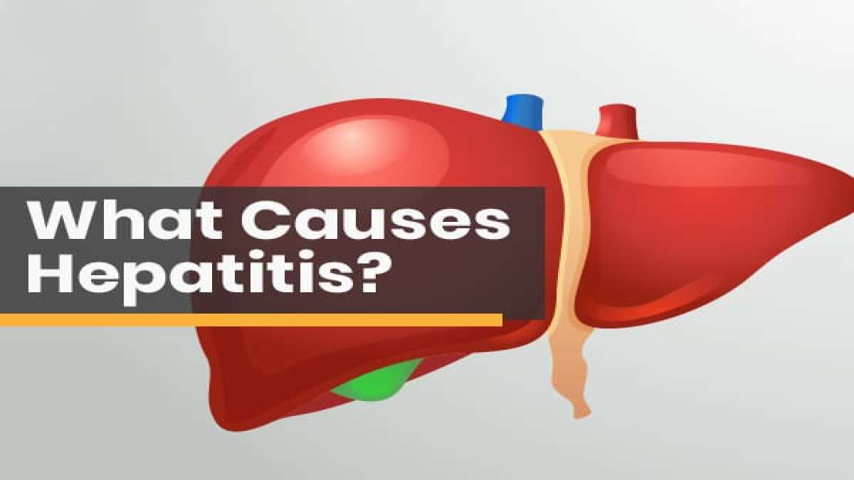 Hepatitis: Causes, Types, Symptoms, Complications, Diagnosis And ...