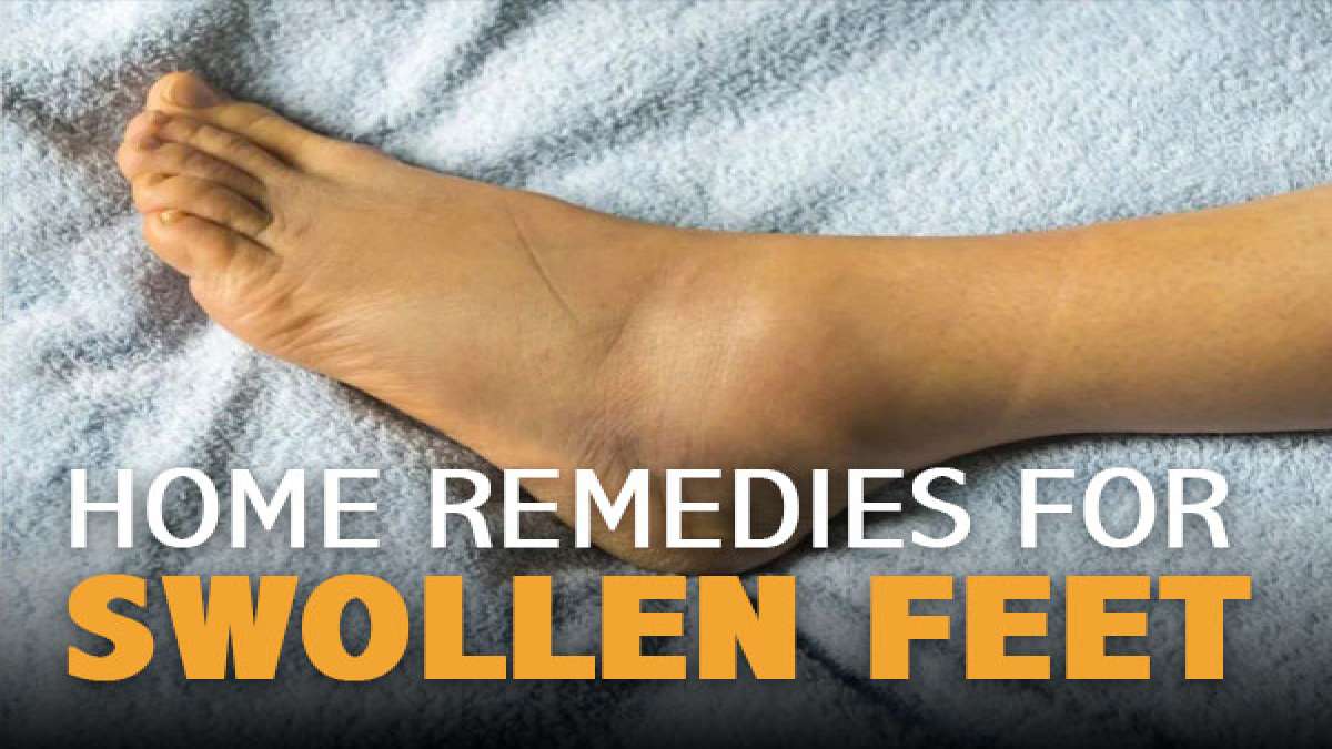 12 Effective Home Remedies For Swollen Feet - Boldsky.com