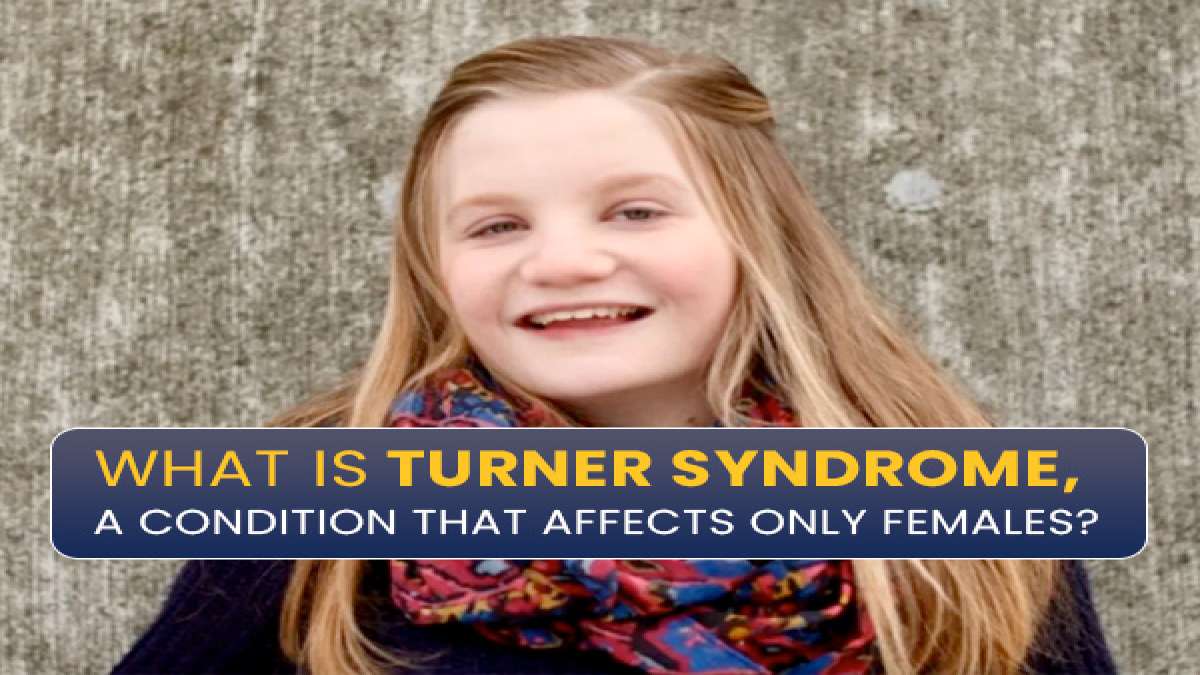 Turner Syndrome: Causes, Symptoms, Complications And Treatments ...