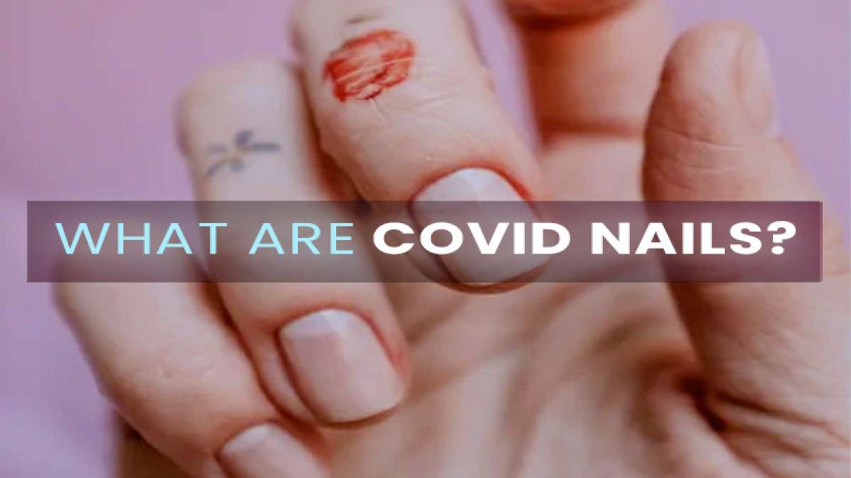 COVID Nails: Is It A Serious Sign Related To COVID-19? - Boldsky.com