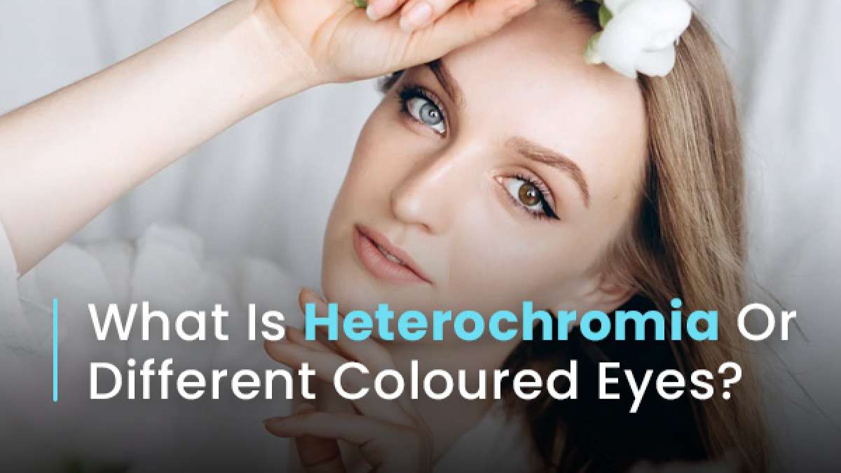 What Is Heterochromia Or Different Coloured Eyes In Humans? Causes ...