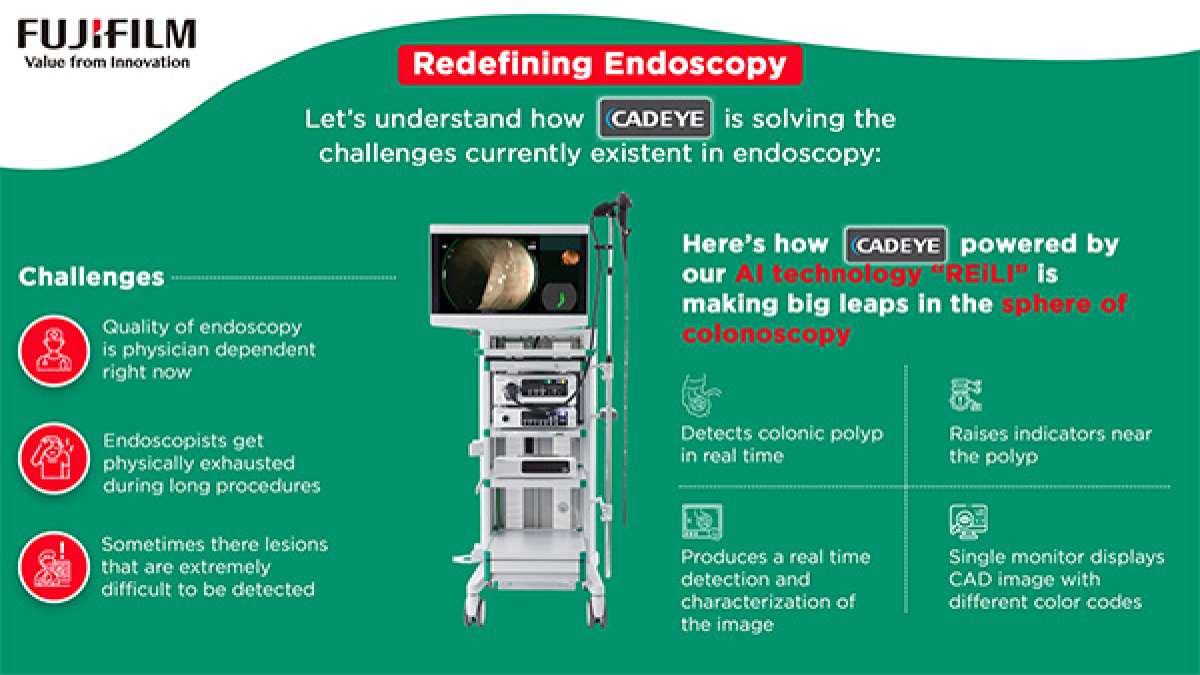 fujifilm-launches-new-software-version-of-cad-eye-in-india - Boldsky.com