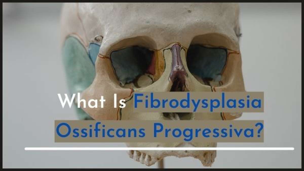 Fibrodysplasia Ossificans Progressiva: Symptoms, Causes, Risks ...
