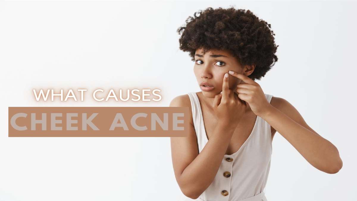 Got Cheek Acne? Here's How You Can Manage It - Boldsky.com