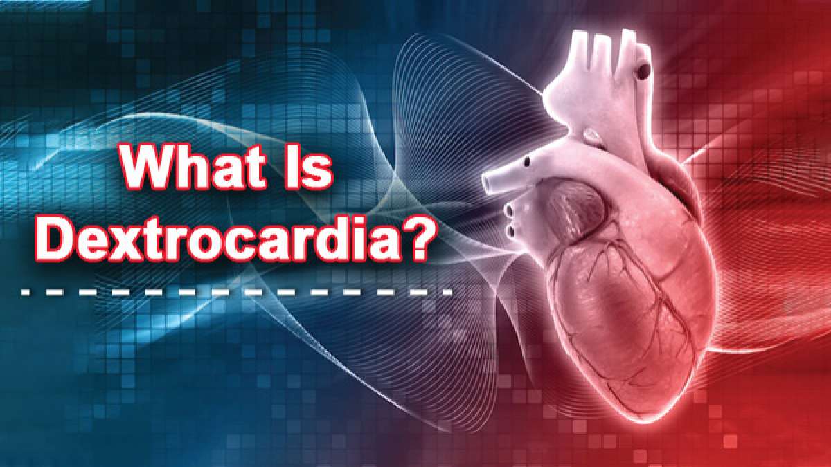 Can A Person Live With Dextrocardia? Causes, Symptoms And Treatments ...