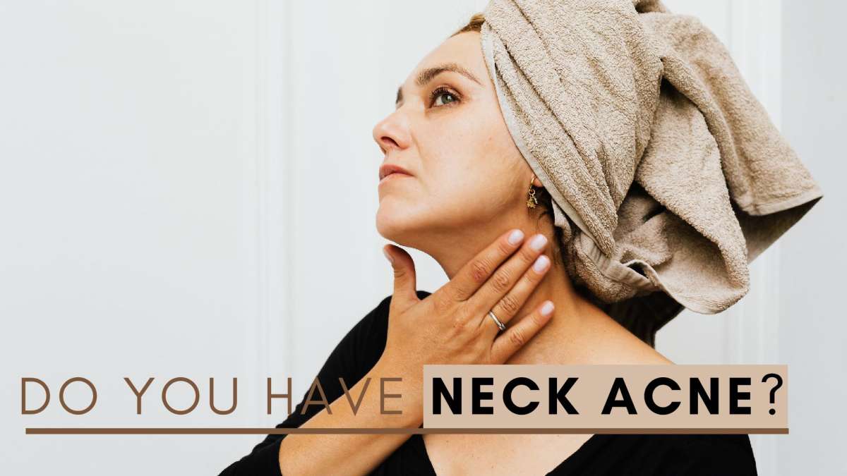 Do You Have Neck Acne? Here's How You Can Get Rid Of It! - Boldsky.com