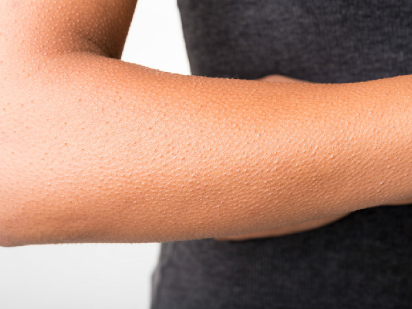 5 Skin Symptoms And What They Could Mean - Boldsky.com