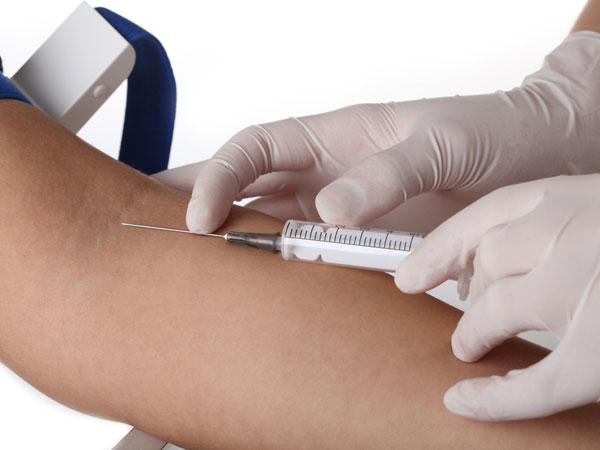 10 Ways To Prevent Jaundice - Boldsky.com