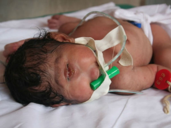 10 Strange Medical Cases Reported In India - Boldsky.com