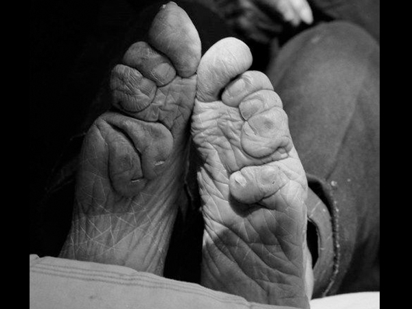The Barbaric Chinese Fashion Fad: The Lotus Feet - Boldsky.com